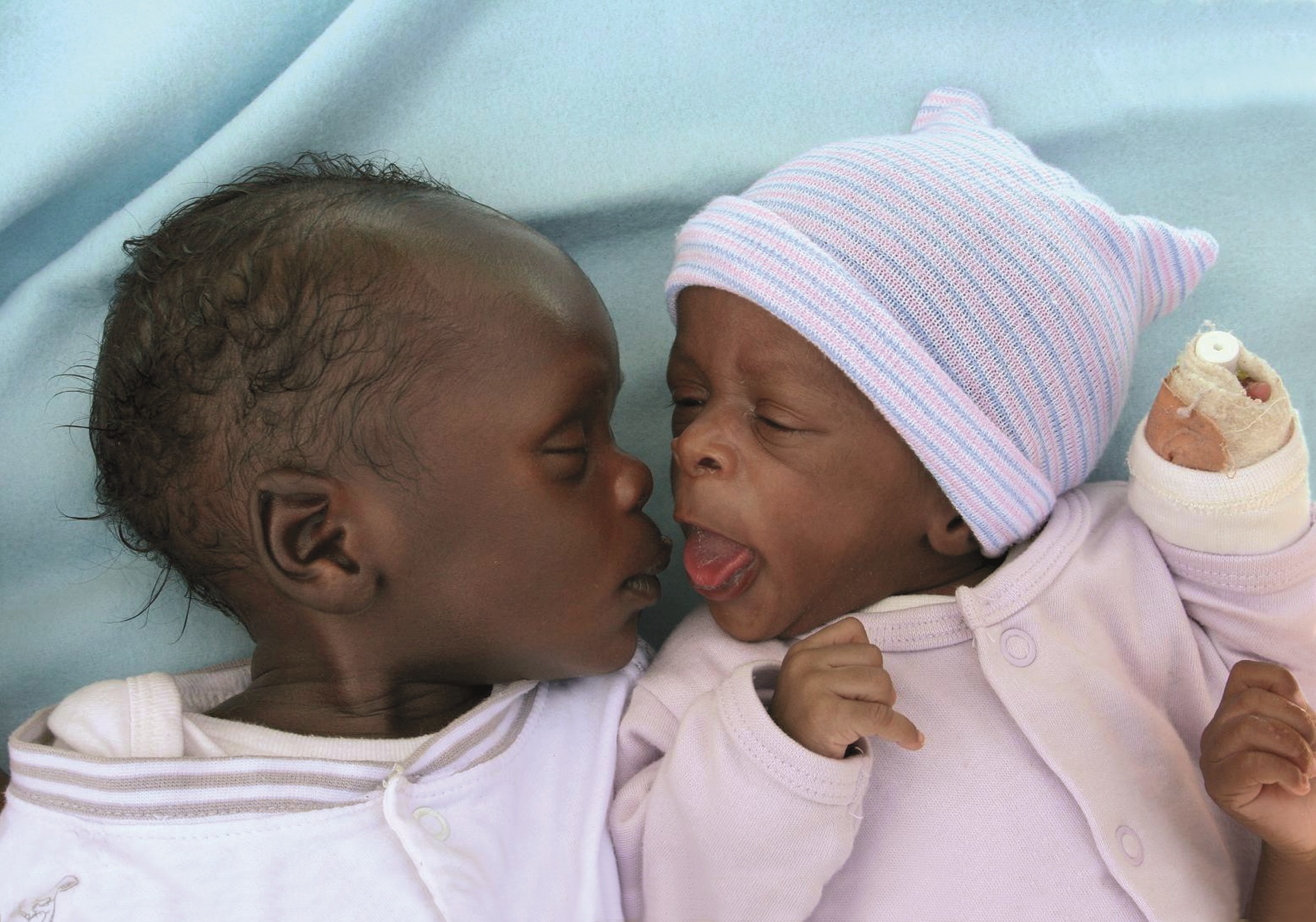 Pressefotos von Samaritan's Purse - Samaritan's Purse